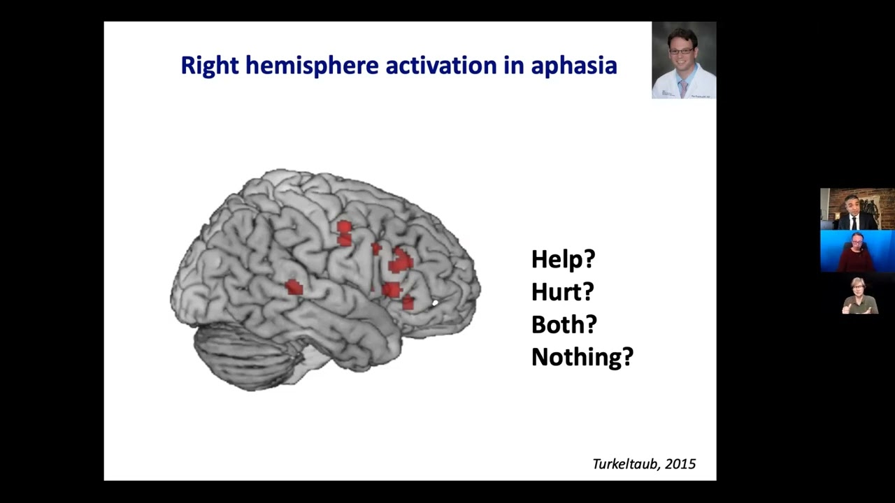 Employing Brain Stimulation To Enhance Language Processing In Aphasia ...